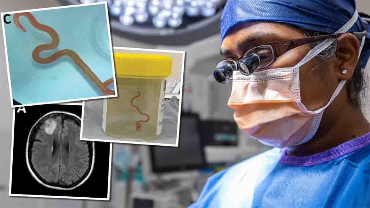 World's First: Surgeons Remove… - Commonwealth Union